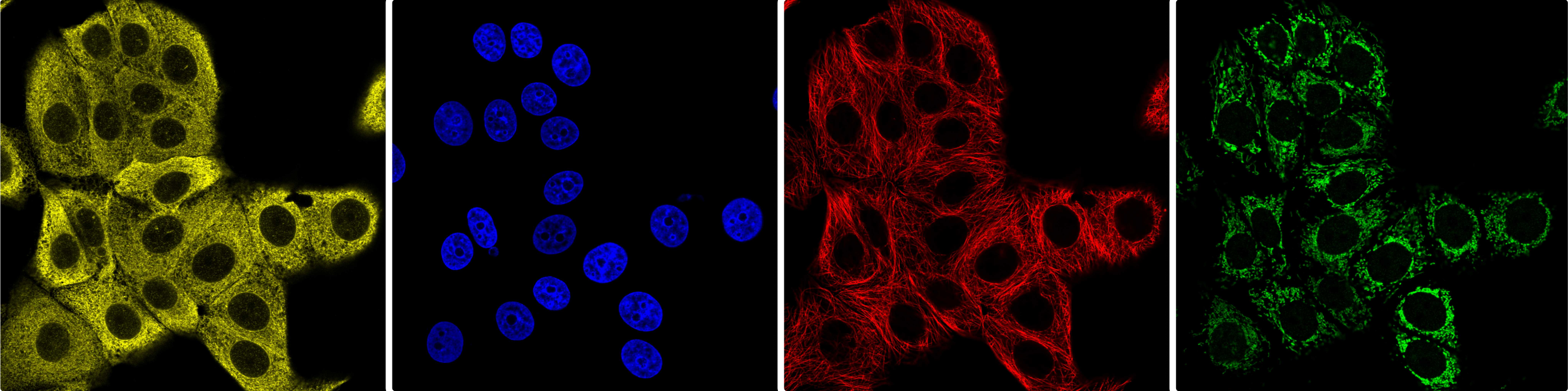 Virtual Cell Platform | Examining protein localization changes ...
